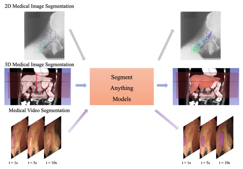 MedSAM: Accurate, Prompt-Based Medical Image Segmentation Out of the ...